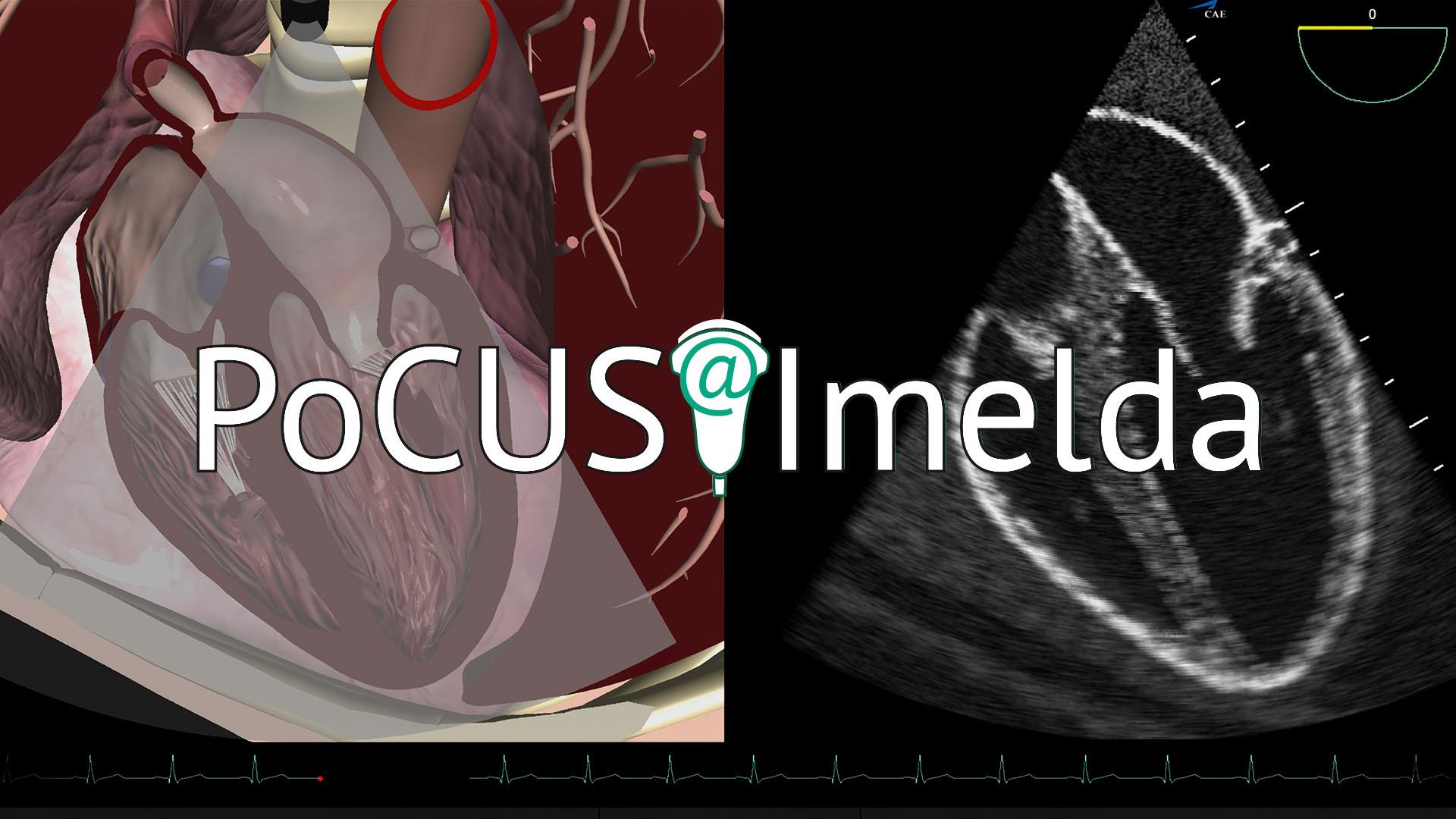 Curriculum in Point-of-Care UltraSound